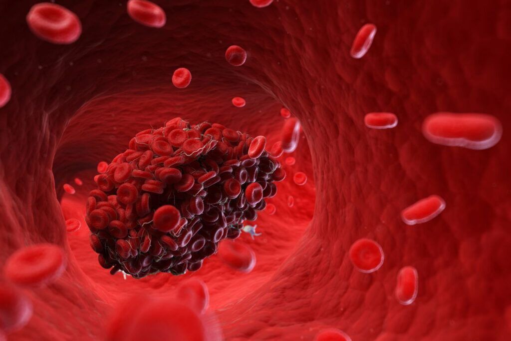 Why You Should Care If Your Blood Cells Are Clumped - Fabulous50s ...